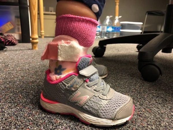 First Time Orthotics - ABC Pediatric Therapy