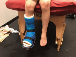 Serial Casting - ABC Pediatric Therapy