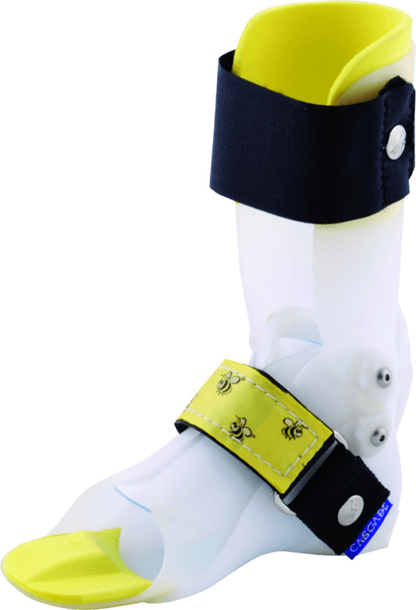 Splinting - ABC Pediatric Therapy