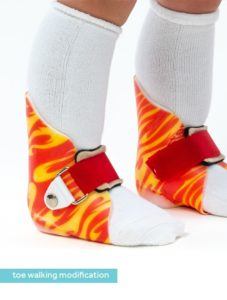 Splinting - ABC Pediatric Therapy